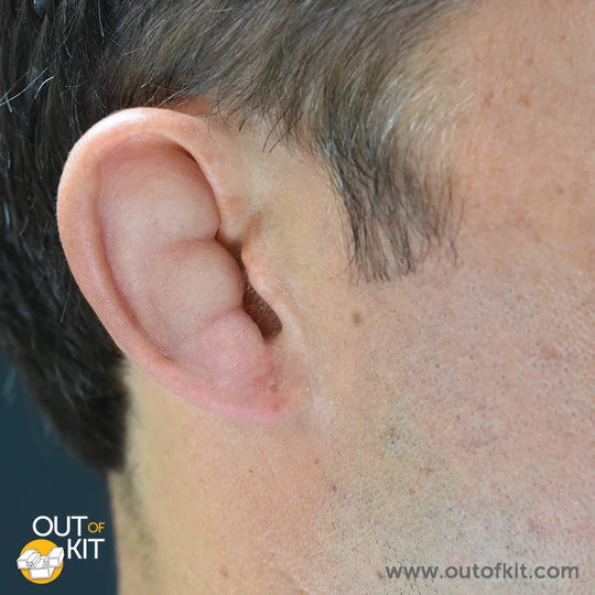 Out of Kit Cauliflower Ear Right — Coast Fiber Tek